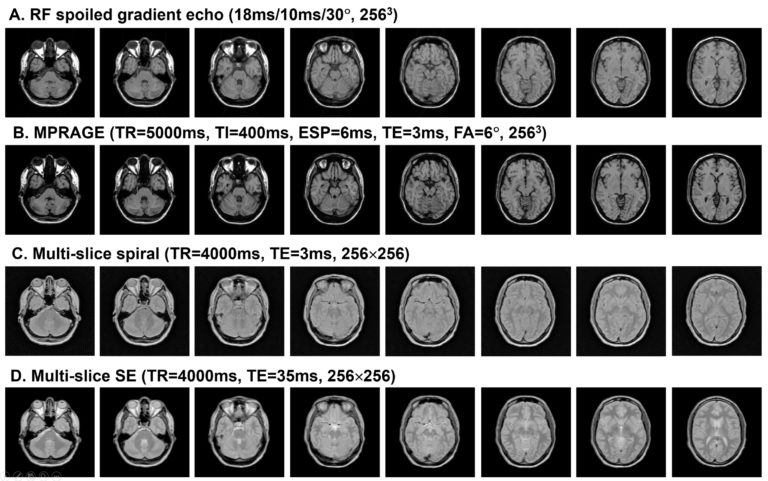 Simulation for the brain phantom | BlochSolver