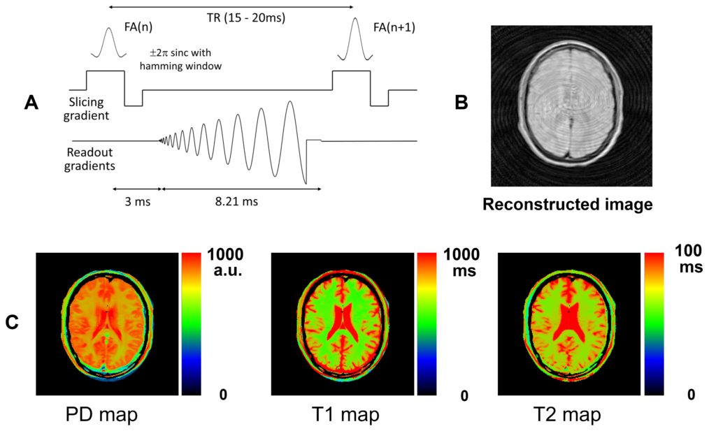 Simulation for the brain phantom | BlochSolver
