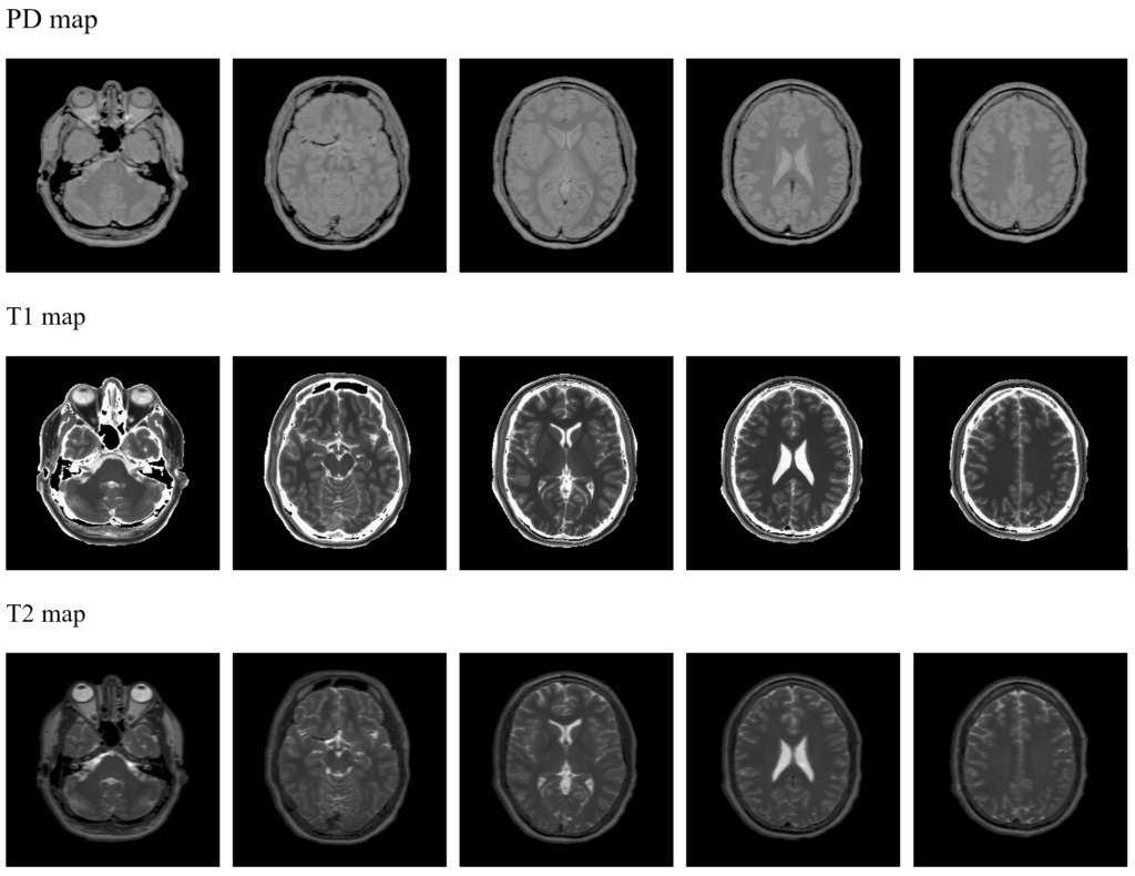 Digital Brain Phantom | BlochSolver