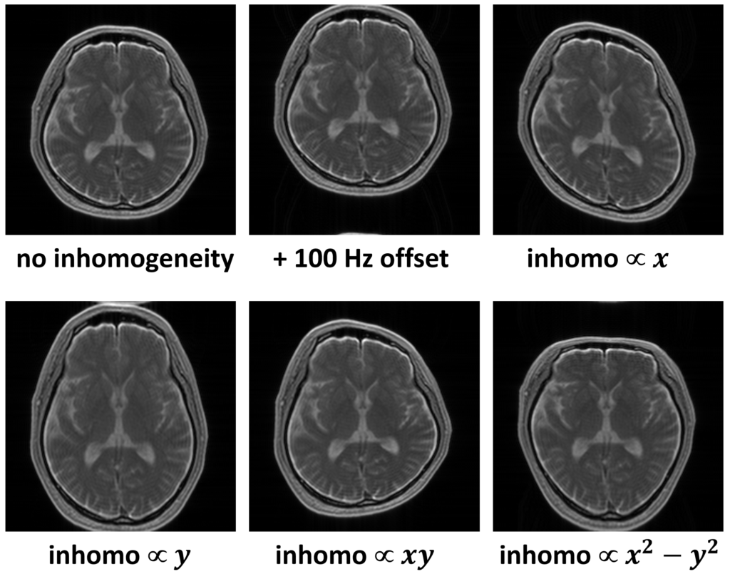 2D_EPI_2080p_3T | BlochSolver