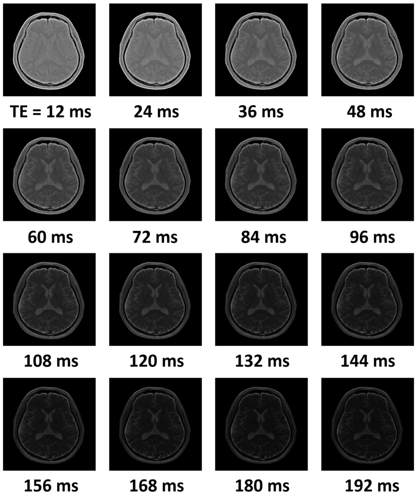 2D_multiple_SE_2080p_3T | BlochSolver