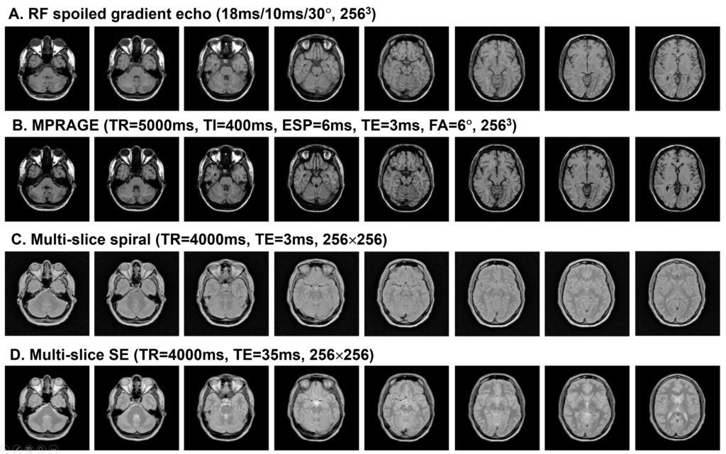 Simulation for the brain phantom | BlochSolver